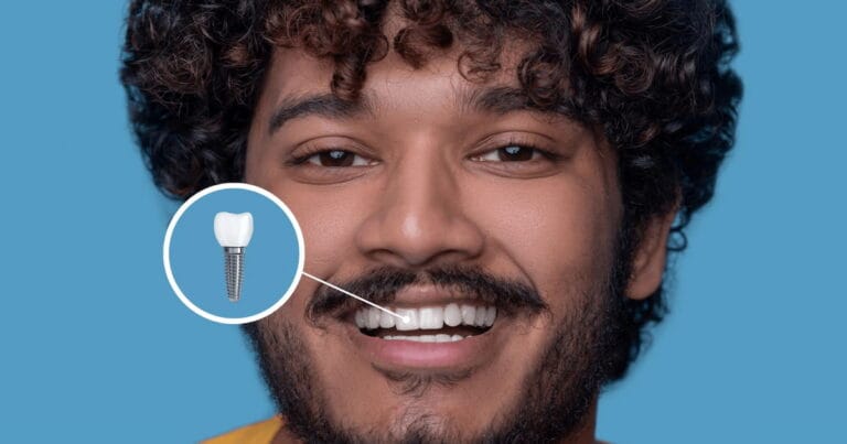 Elements You Should Notice Before Getting a Tooth Implant